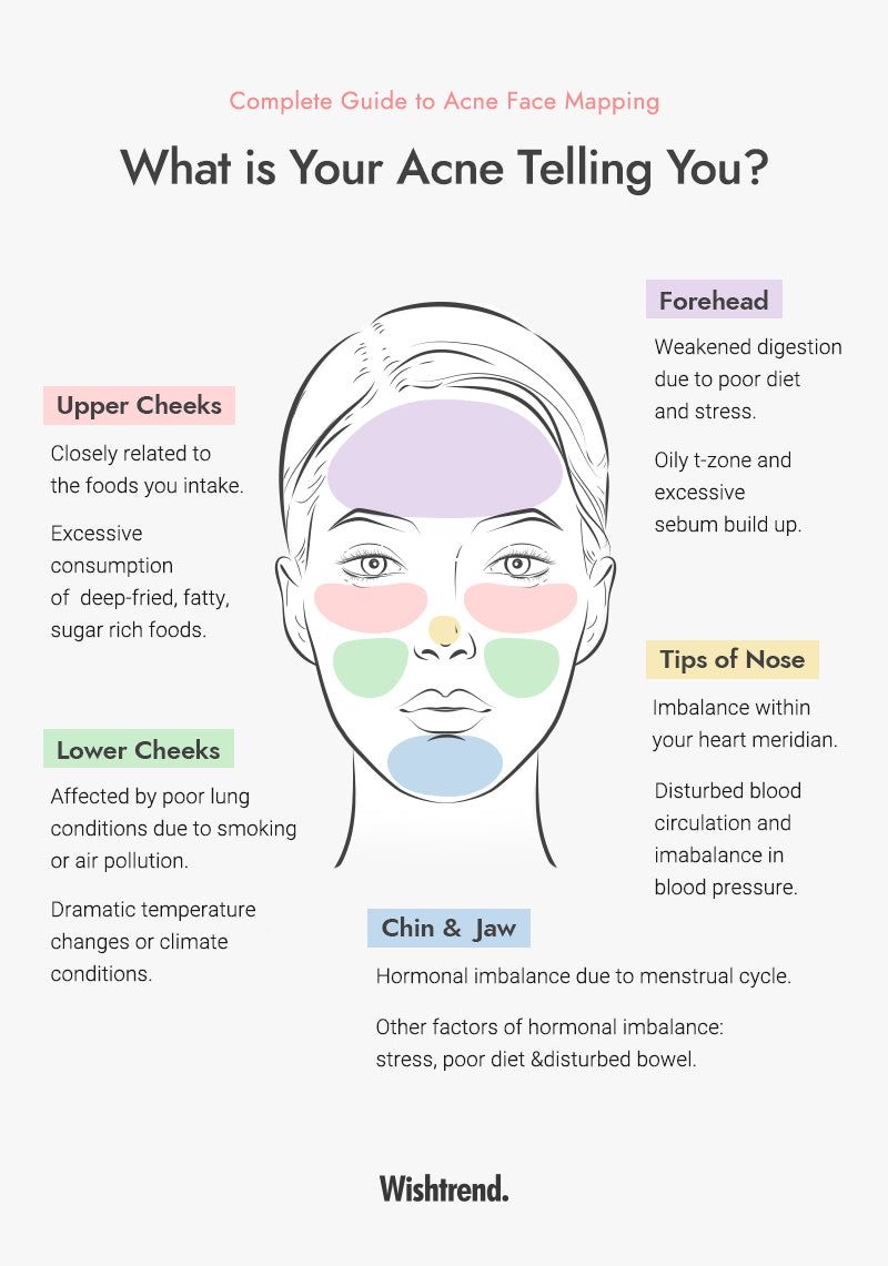 The Ultimate Acne Map Guide For A Clearer Complexion – Aly's Allure